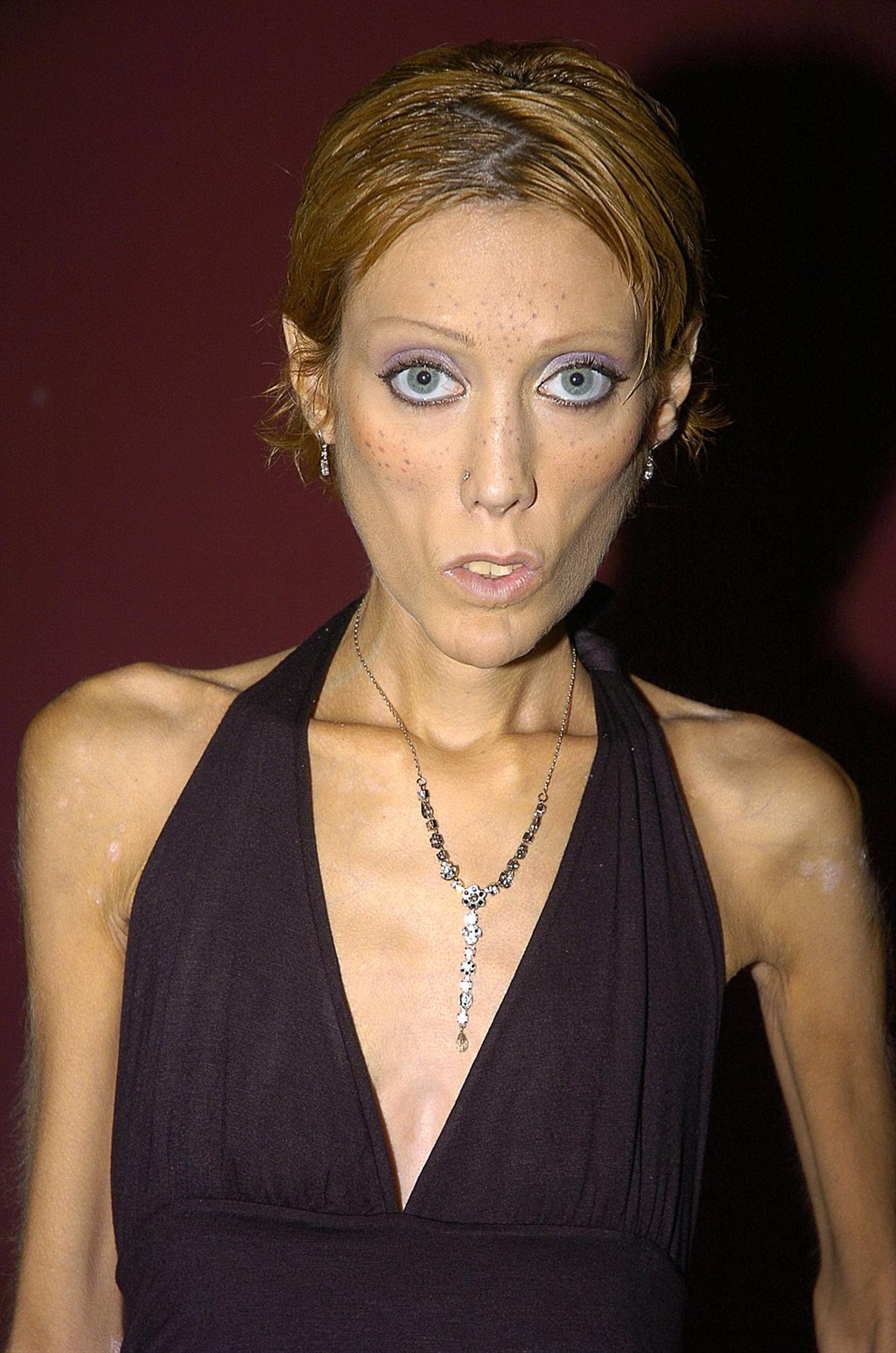 Muere Isabelle Caro, la modelo anoréxica de la campaña de Toscani