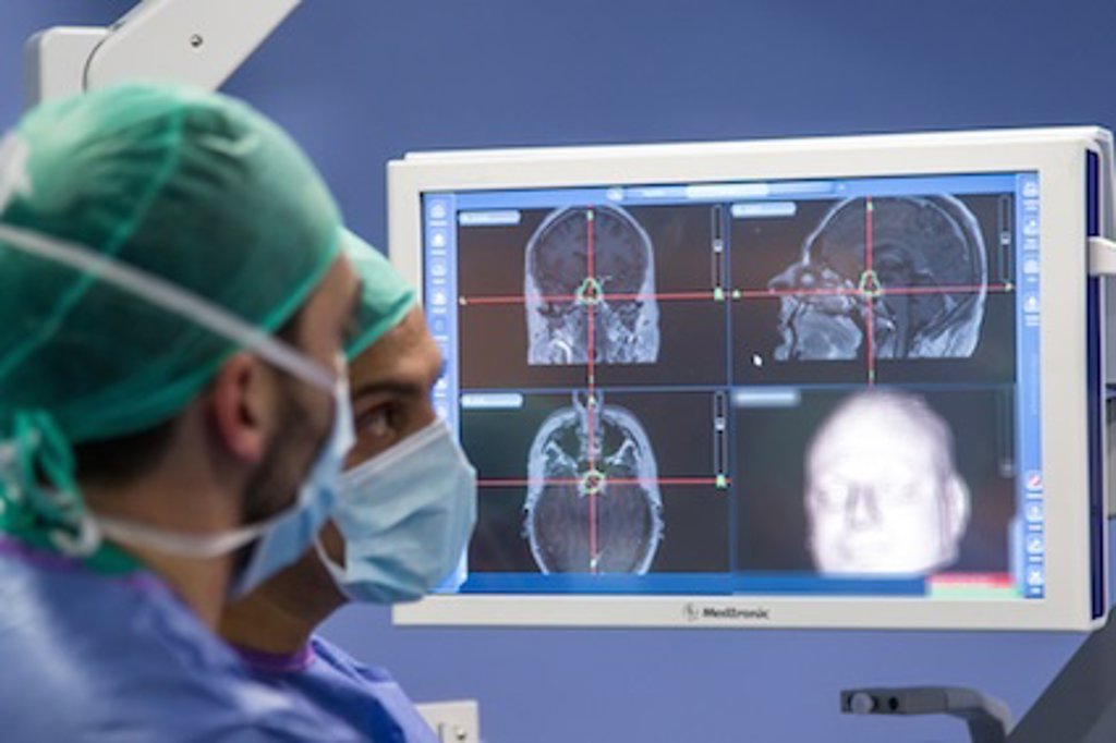 El abordaje endoscópico con neuronavegador reduce riesgos en el adenoma de hipófisis