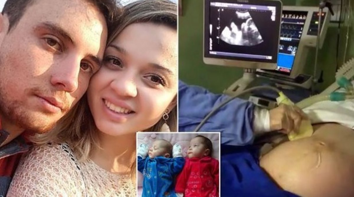 Mantienen Con Vida A Una Brasileña Con Muerte Cerebral 123 Días Para