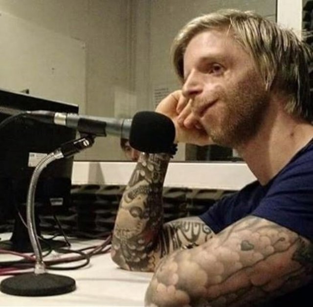 Tiene una enfermedad rara y ahora está en Argentina para compartir su ...