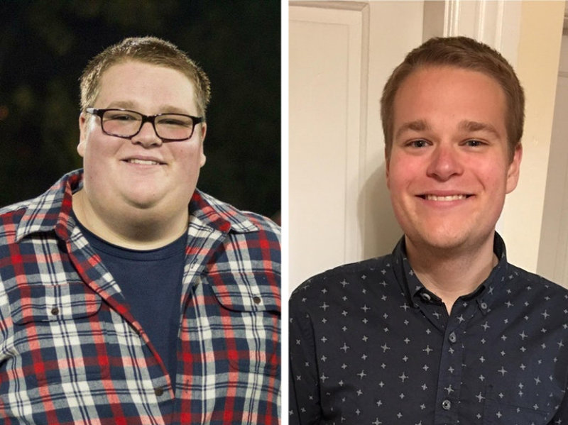 Fotos: Así de radical se transforma un rostro cuando se pierde mucho peso