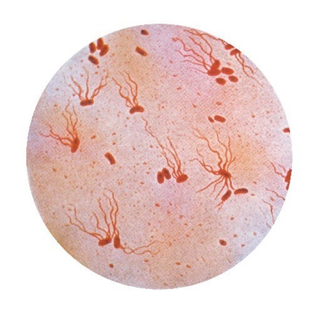 Detectan una nueva 'superbacteria' de fiebre tifoidea causante de un ...