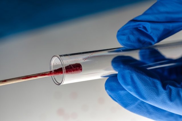 La genética forense está permitiendo resolver delitos que hace unos ...