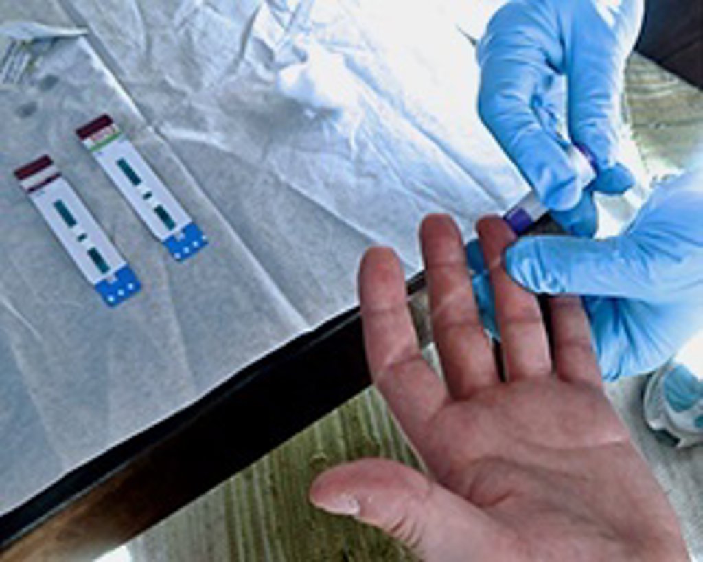 Detallan la limitación de las terapias que buscan destruir reservorios ...