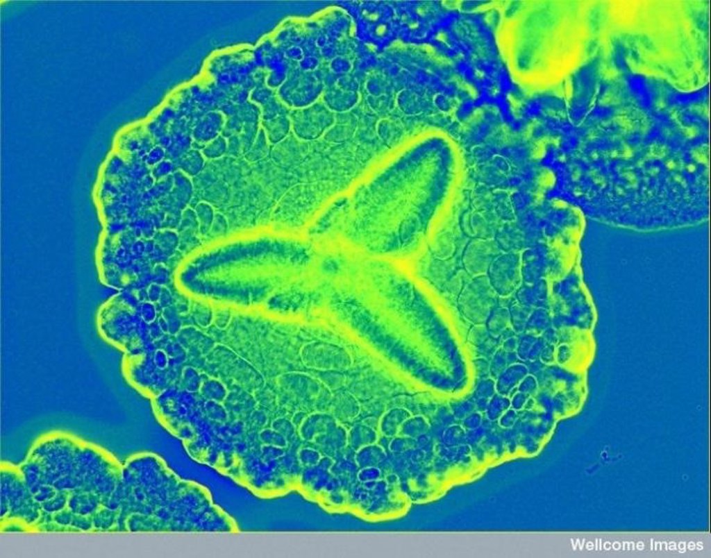 Las bacterias de la enfermedad periodontal funcionan mejor con ...