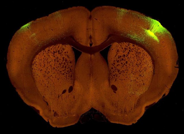 Realizan un nuevo mapa de alta resolución de cómo está conectado el cerebro