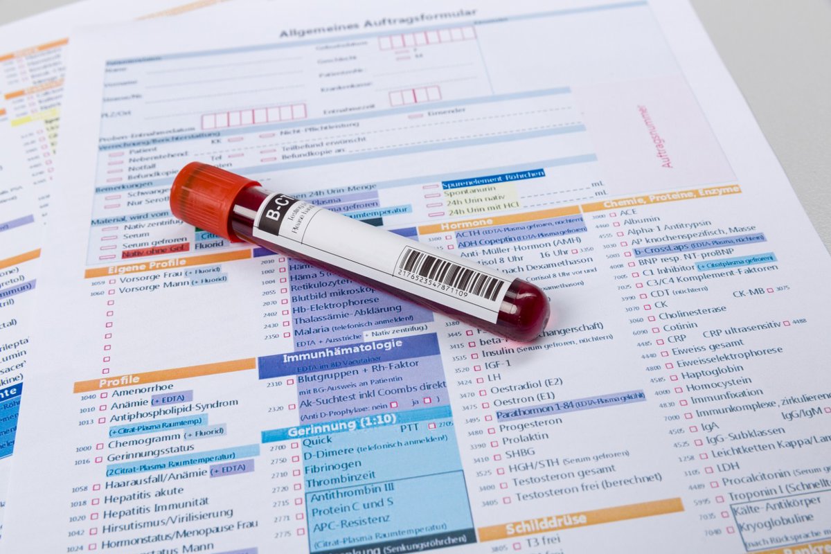 C mo Interpretar Correctamente Un An lisis De Sangre