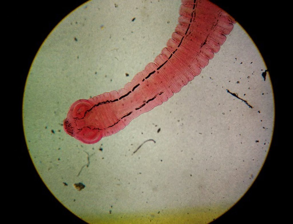 ¿qué Es La Infección Por Toxocariasis ¿qué Síntomas Tieneemk 9888