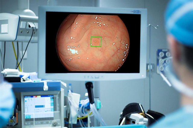 El Grupo HLA incorpora la inteligencia artificial para detectar pólipos ...