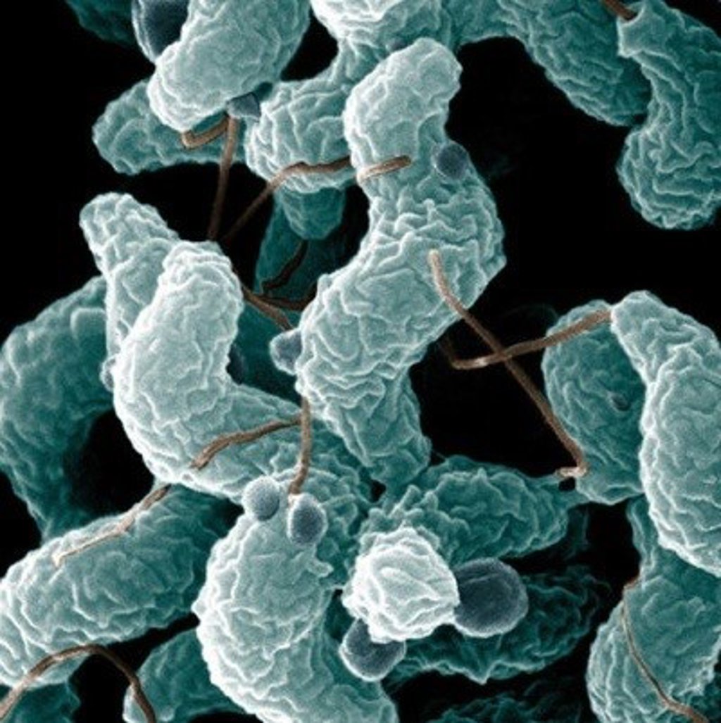 Investigadores descubren dos nuevas especies de bacterias patógenas ...
