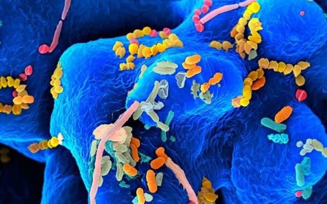 La estructura genómica de las comunidades microbianas puede predecir la ...