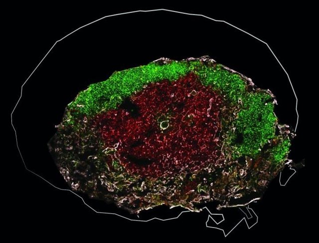 Un estudio en lombrices intestinales demuestra que se puede retrasar el ...