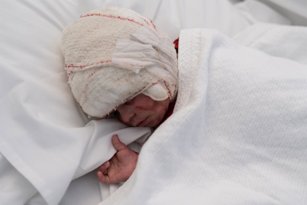 O.Próximo.- UNICEF denuncia la muerte de más de 200 niños en menos de ...